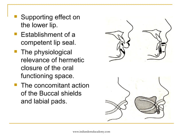 FRANKEL FUNCTION REGULATOR | PPT | Dental Health | Diseases and Conditions