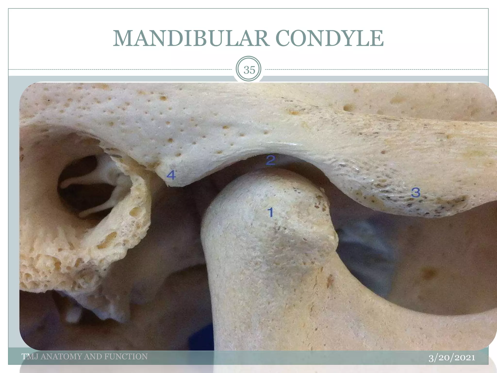 Temporomandibular joint | PPTX