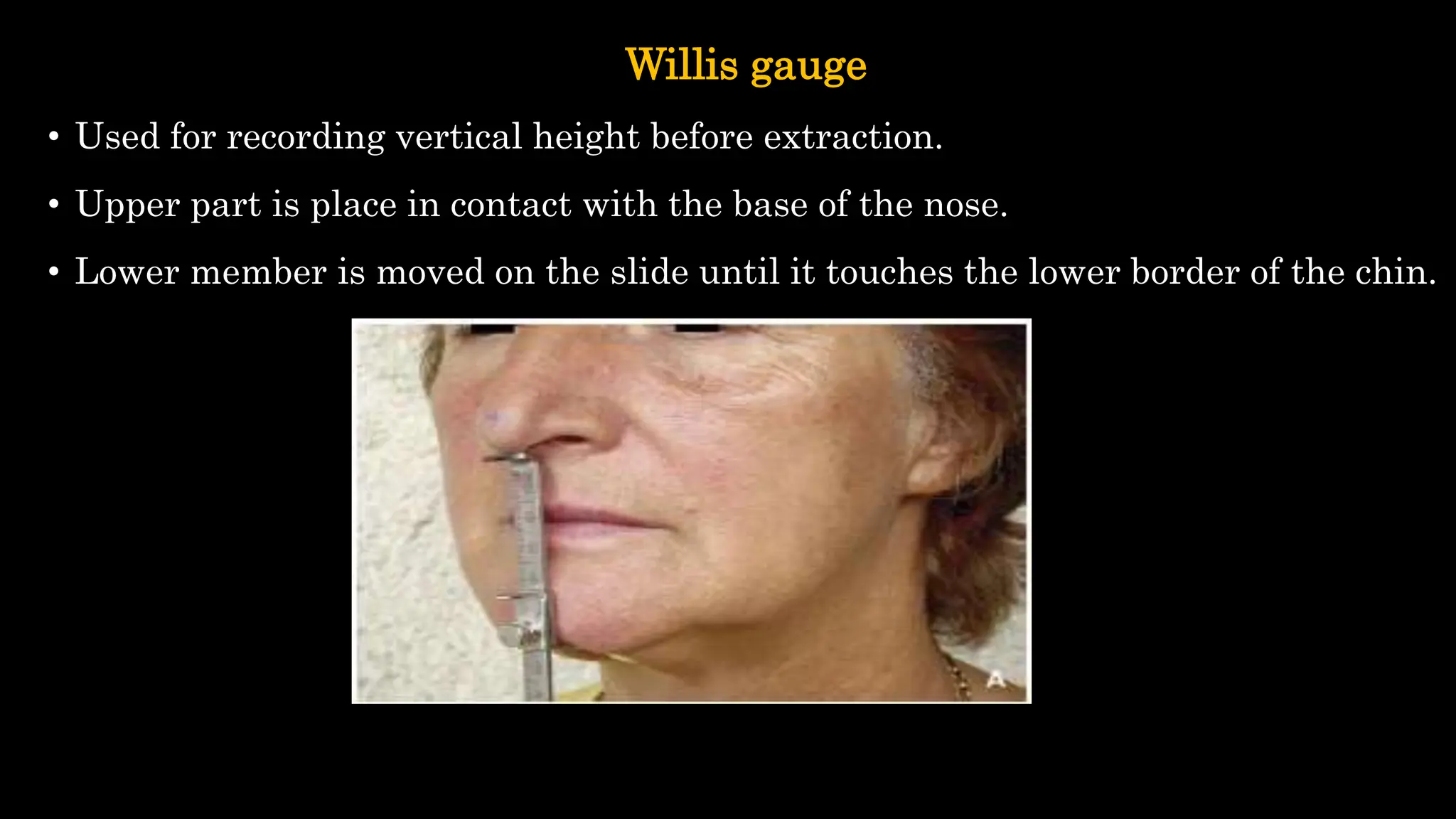 Vertical jaw relation in complete denture | PPTX