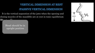 Vertical jaw relation in complete denture | PPTX