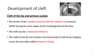 cleft lip and palate in orthodontics.pptx