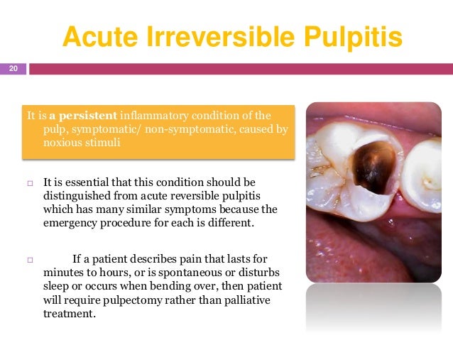 endodontic emergencies