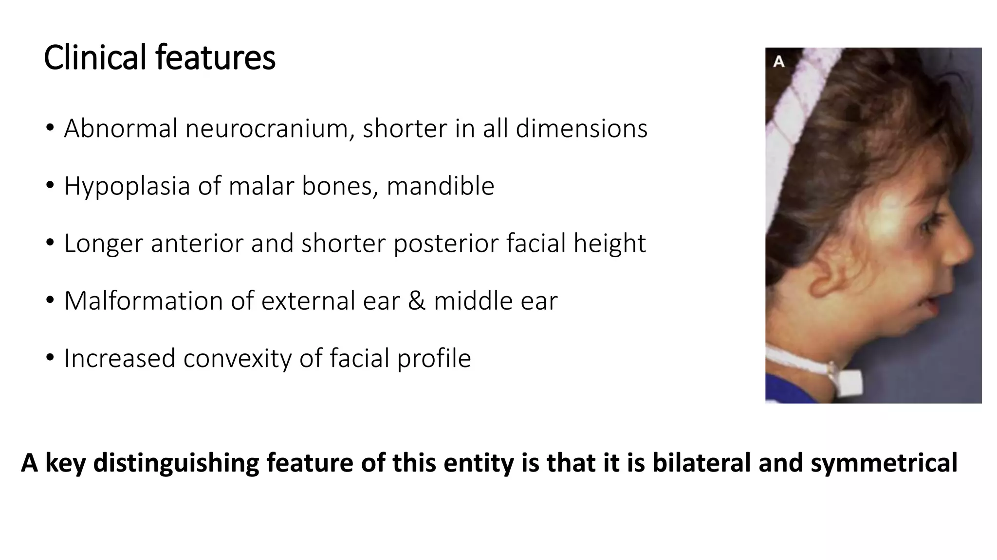DEVELOPMENTAL ANOMALIES - CRANIOFACIAL SYNDROMES | PPTX