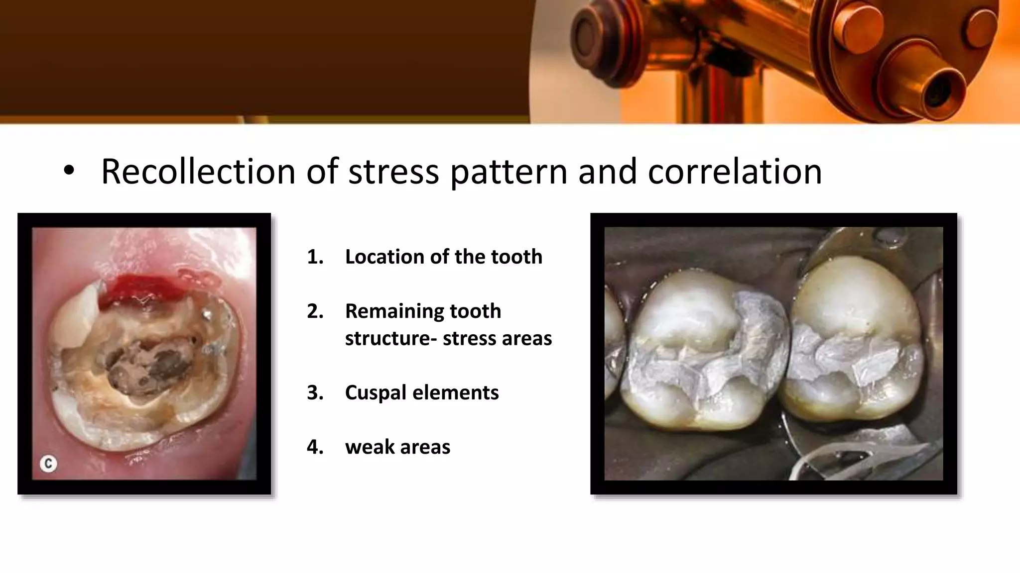 principles for restoration of badly broken teeth | PPTX