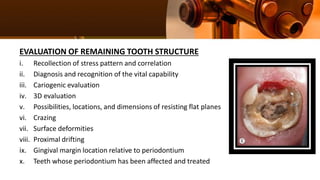 principles for restoration of badly broken teeth | PPTX