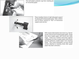 condylar position indicator | PDF