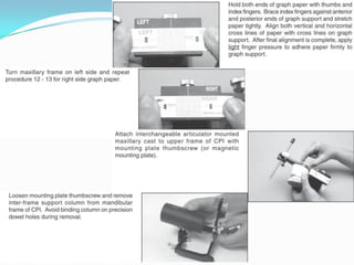 condylar position indicator | PDF