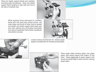 condylar position indicator | PDF