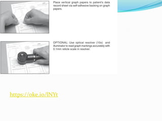 condylar position indicator | PDF
