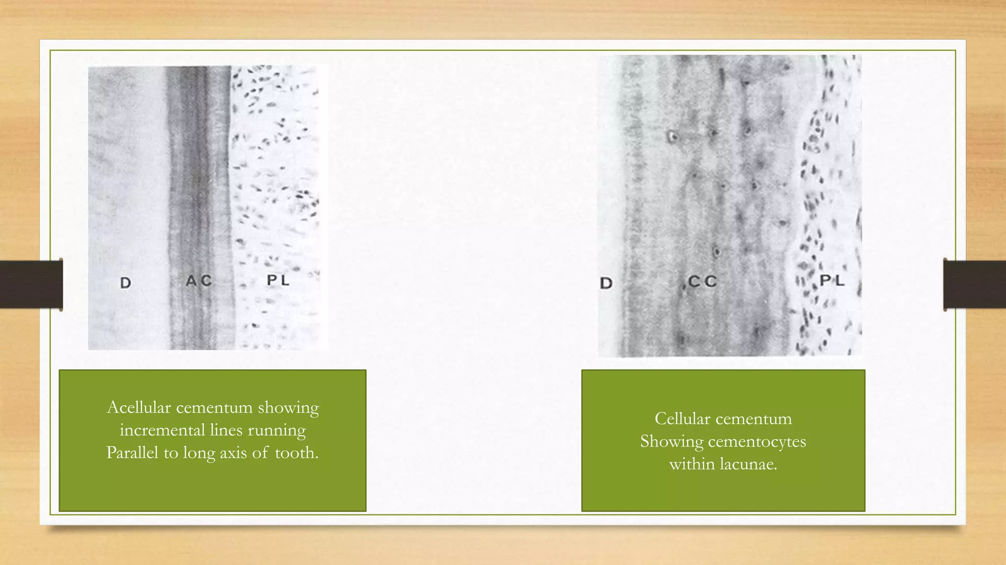 Cementum | PPTX