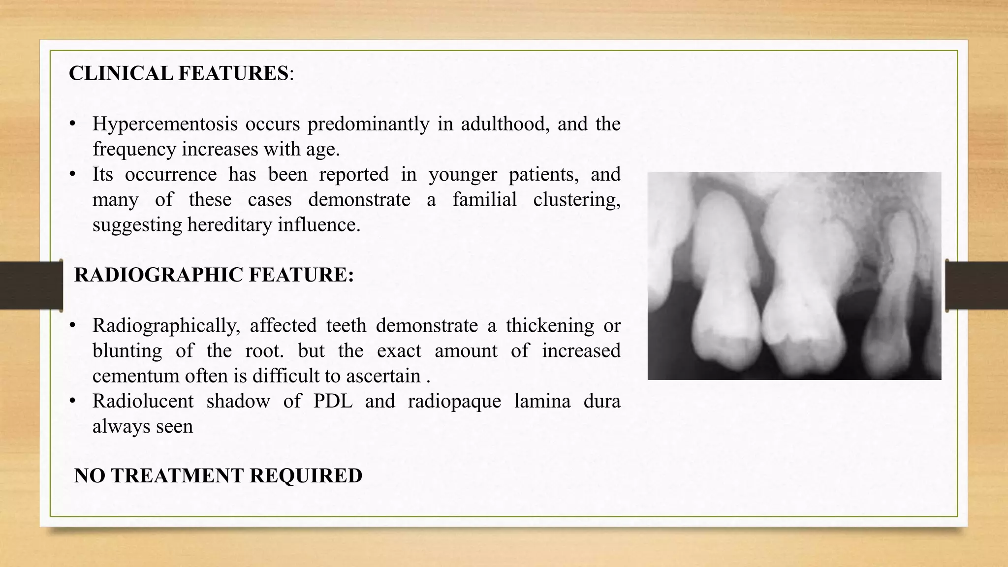 Cementum | PPTX
