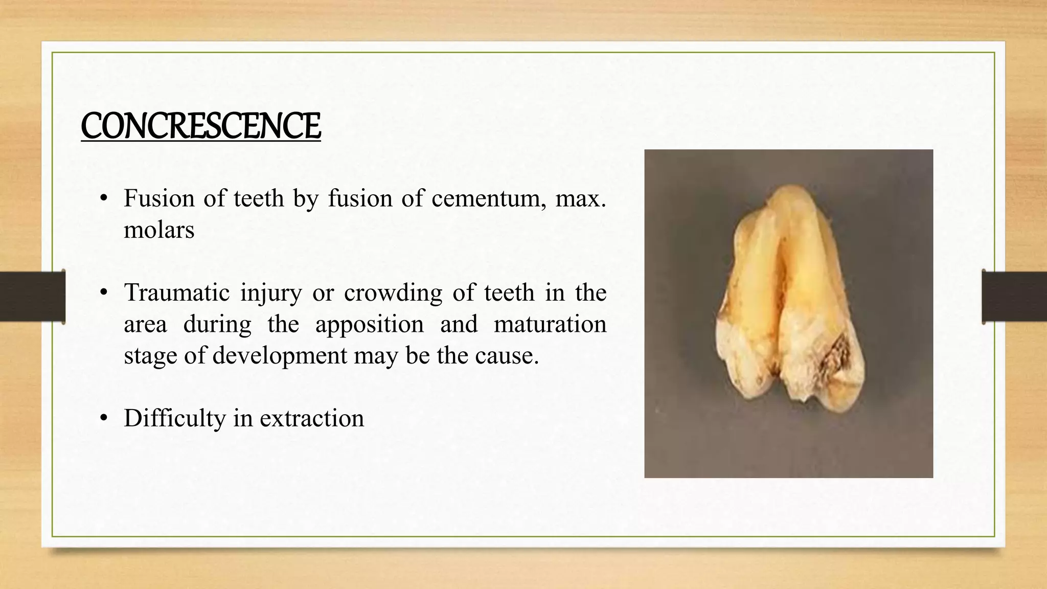 Cementum | PPTX