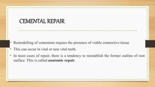 Cementum | PPTX