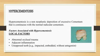 Cementum | PPTX