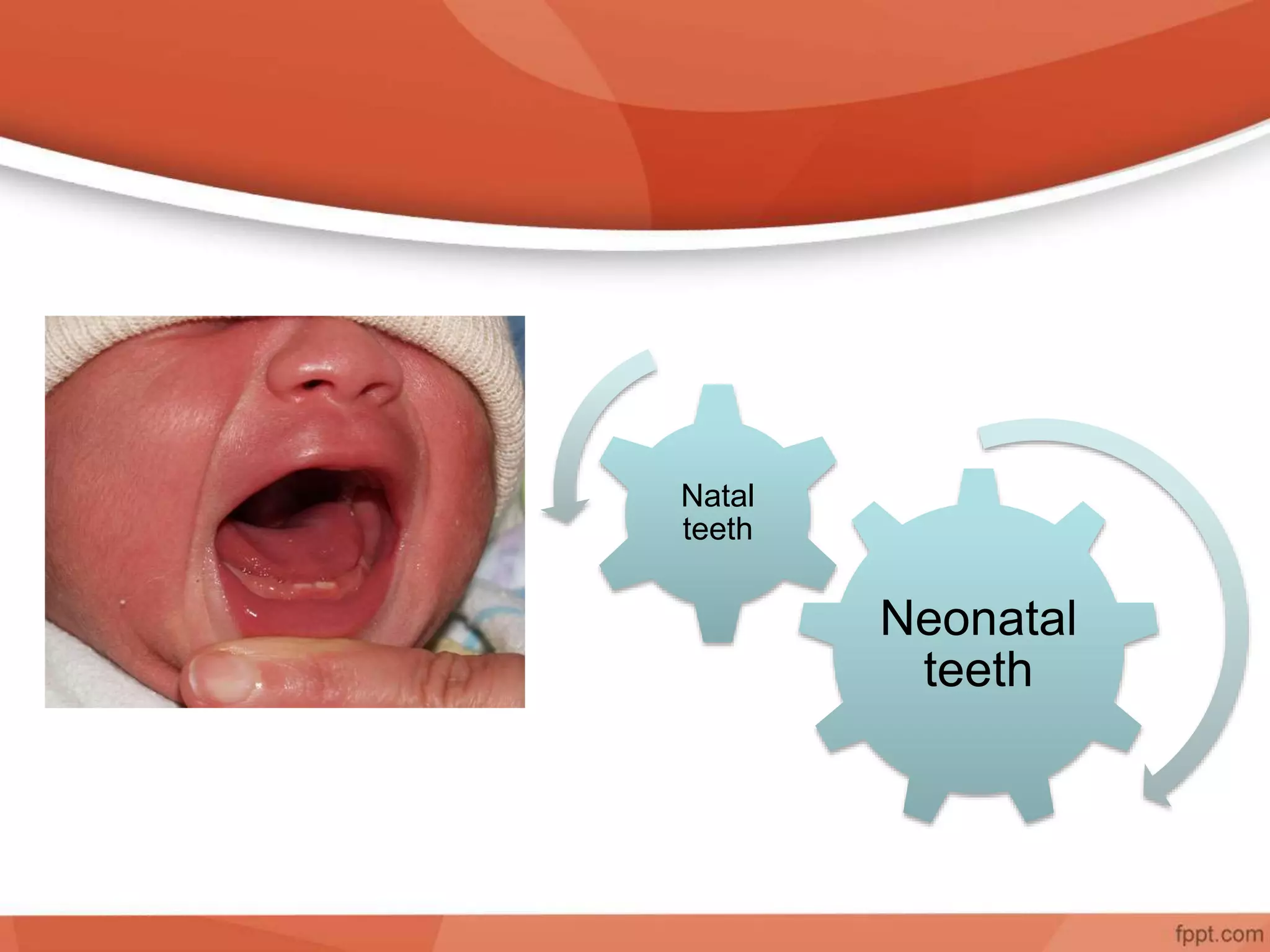 ERUPTION OF TEETH.ppt | Dental Health | Diseases and Conditions