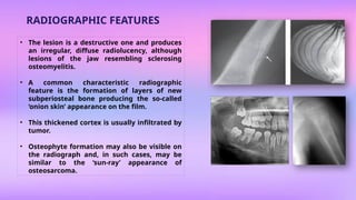 ROUND CELL LESION OF ORAL CAVITY .pptx