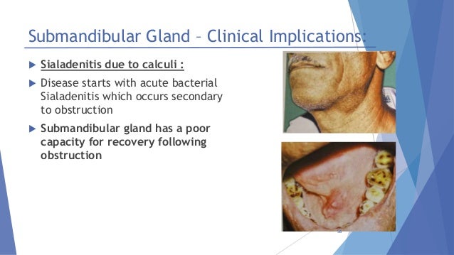 Salivary glands – anatomy and physiology