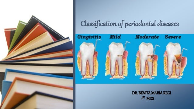 Periodontal Classification Chart