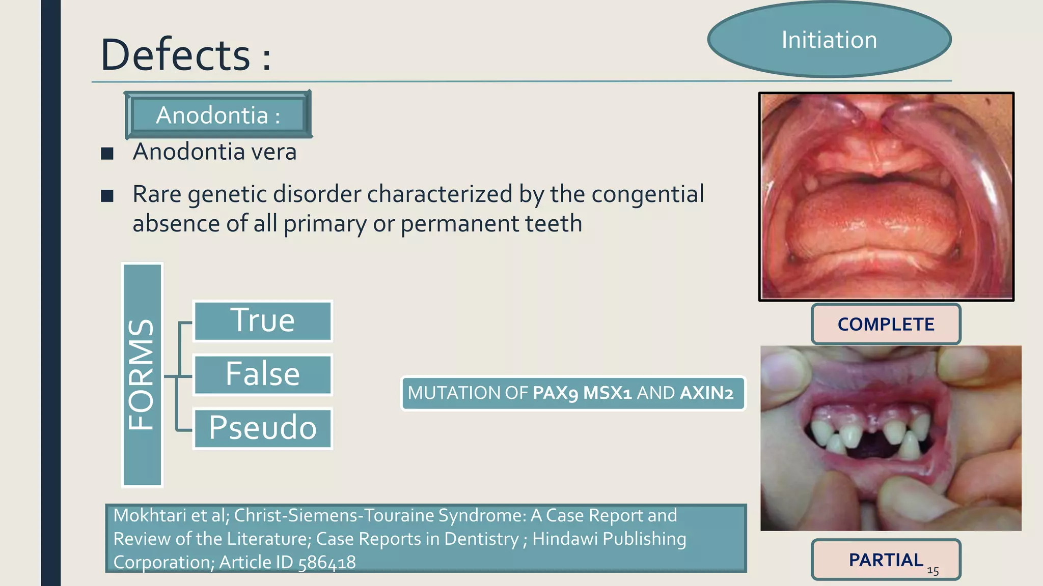Tooth development, eruption & applied aspects | PPTX