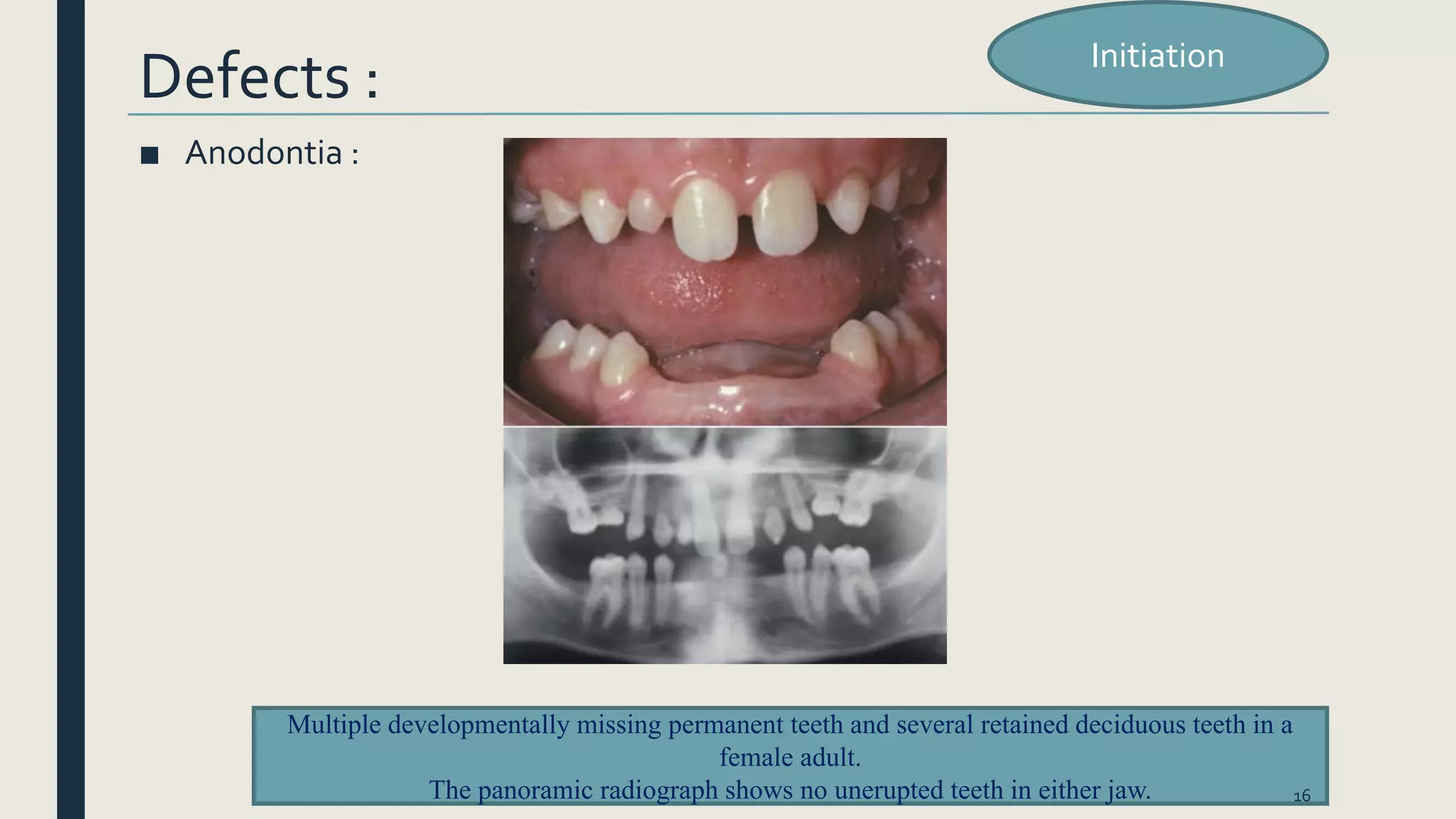 Tooth development, eruption & applied aspects | PPTX