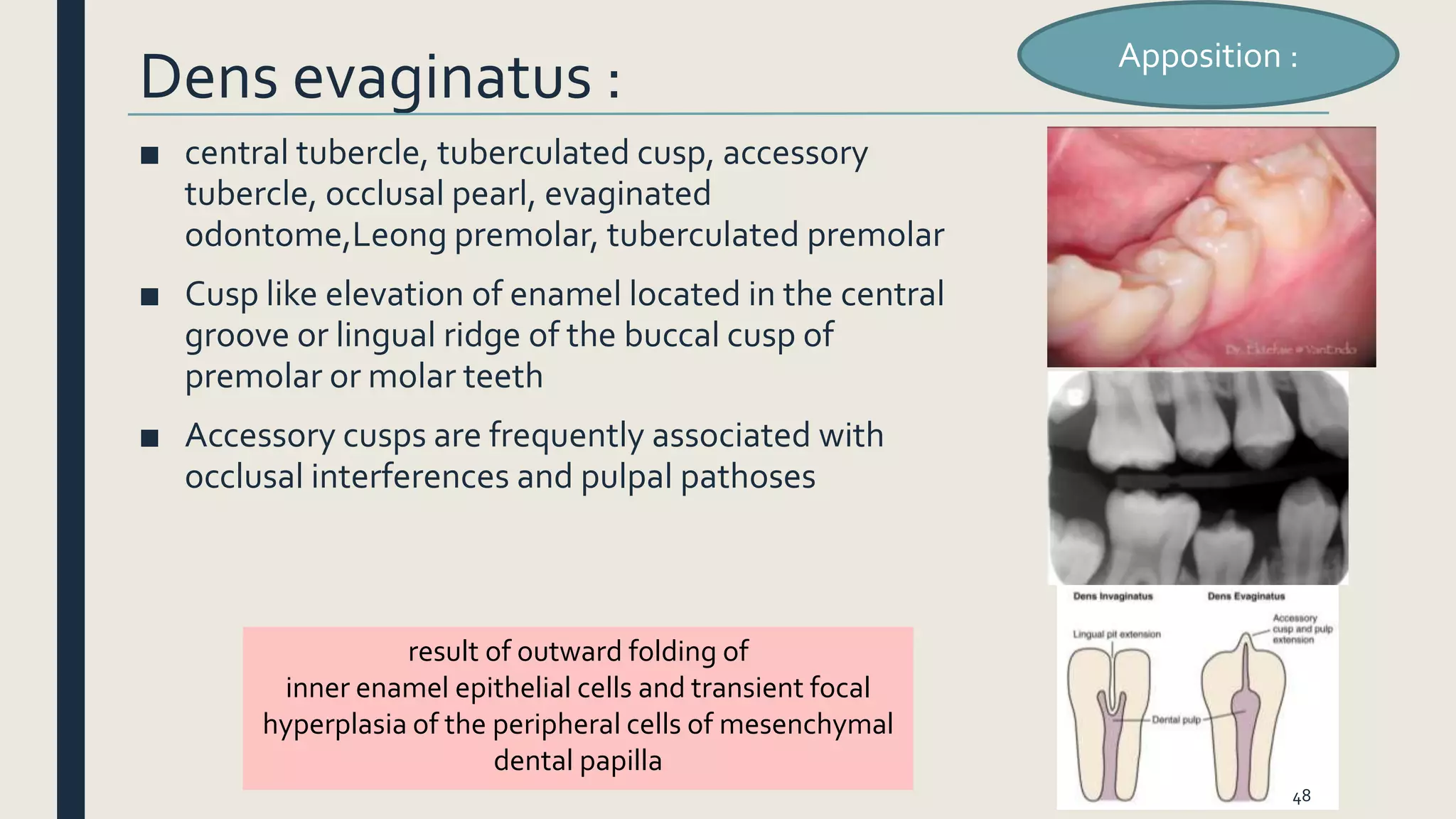 Tooth development, eruption & applied aspects | PPTX