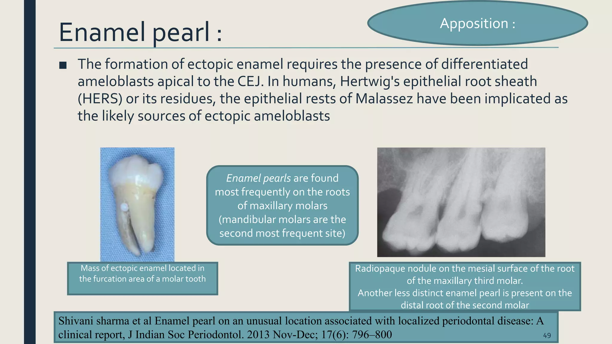 Tooth development, eruption & applied aspects | PPTX