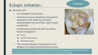 Tooth development, eruption & applied aspects | PPTX