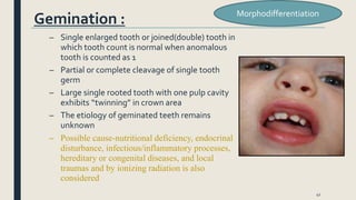 Tooth development, eruption & applied aspects | PPTX
