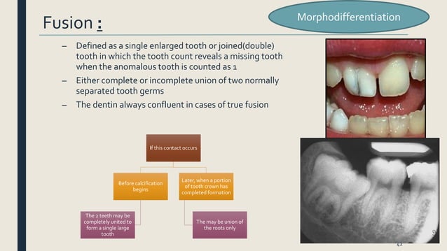 Tooth development, eruption & applied aspects | PPTX