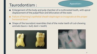 Tooth development, eruption & applied aspects | PPTX