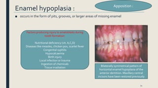 Tooth development, eruption & applied aspects | PPTX