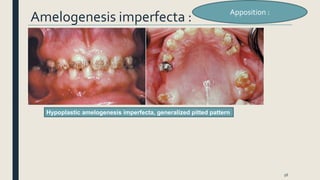 Tooth development, eruption & applied aspects | PPTX