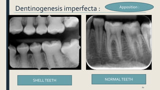 Tooth development, eruption & applied aspects | PPTX