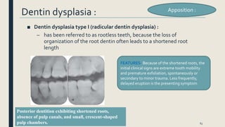 Tooth development, eruption & applied aspects | PPTX