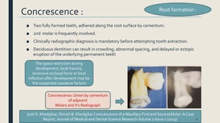 Tooth development, eruption & applied aspects | PPTX
