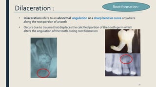 Tooth development, eruption & applied aspects | PPTX