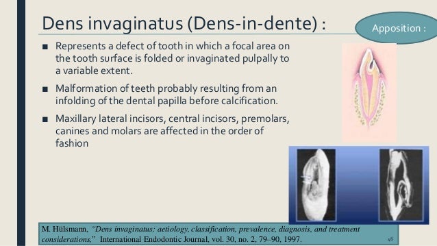 Tooth development, eruption & applied aspects