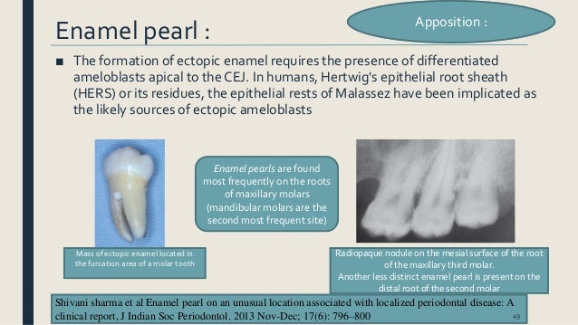 Tooth development, eruption & applied aspects