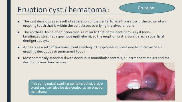 Tooth development, eruption & applied aspects