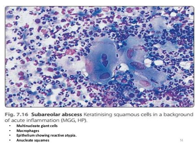 cytology of the breast