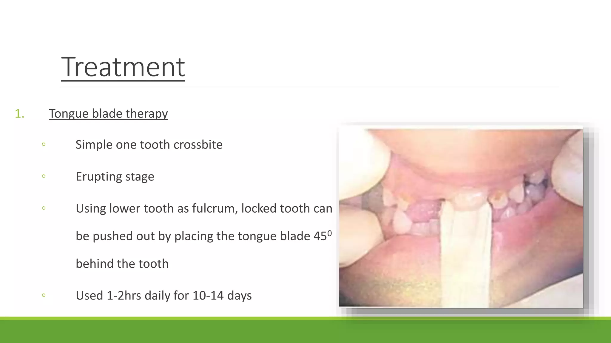 INTERCEPTIVE ORTHODONTICS | PPTX