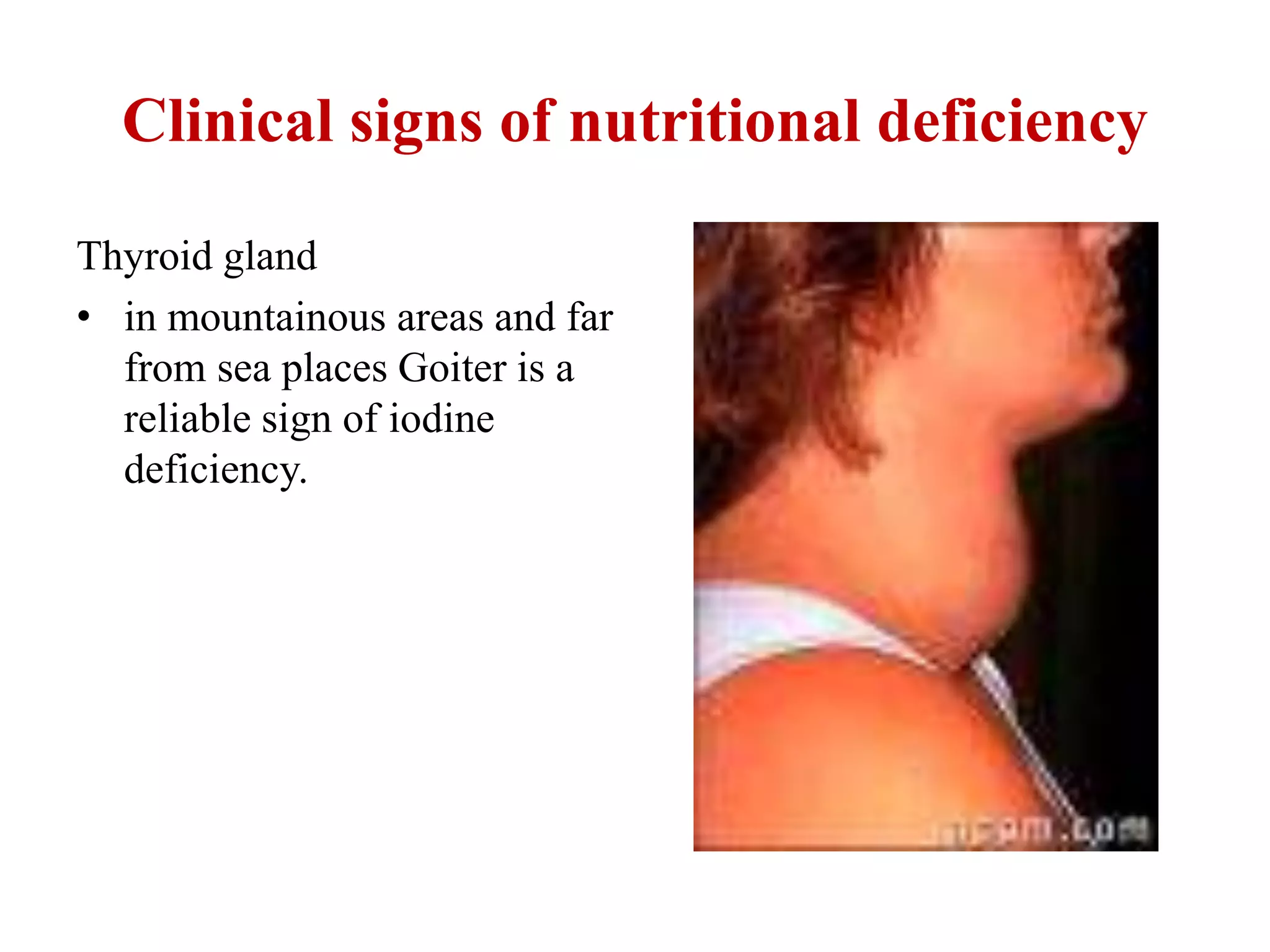 NUTRITIONAL SURVEYS and its evaluation | PPTX