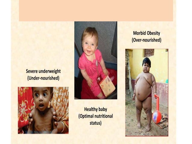 NUTRITIONAL SURVEYS and its evaluation | PPTX