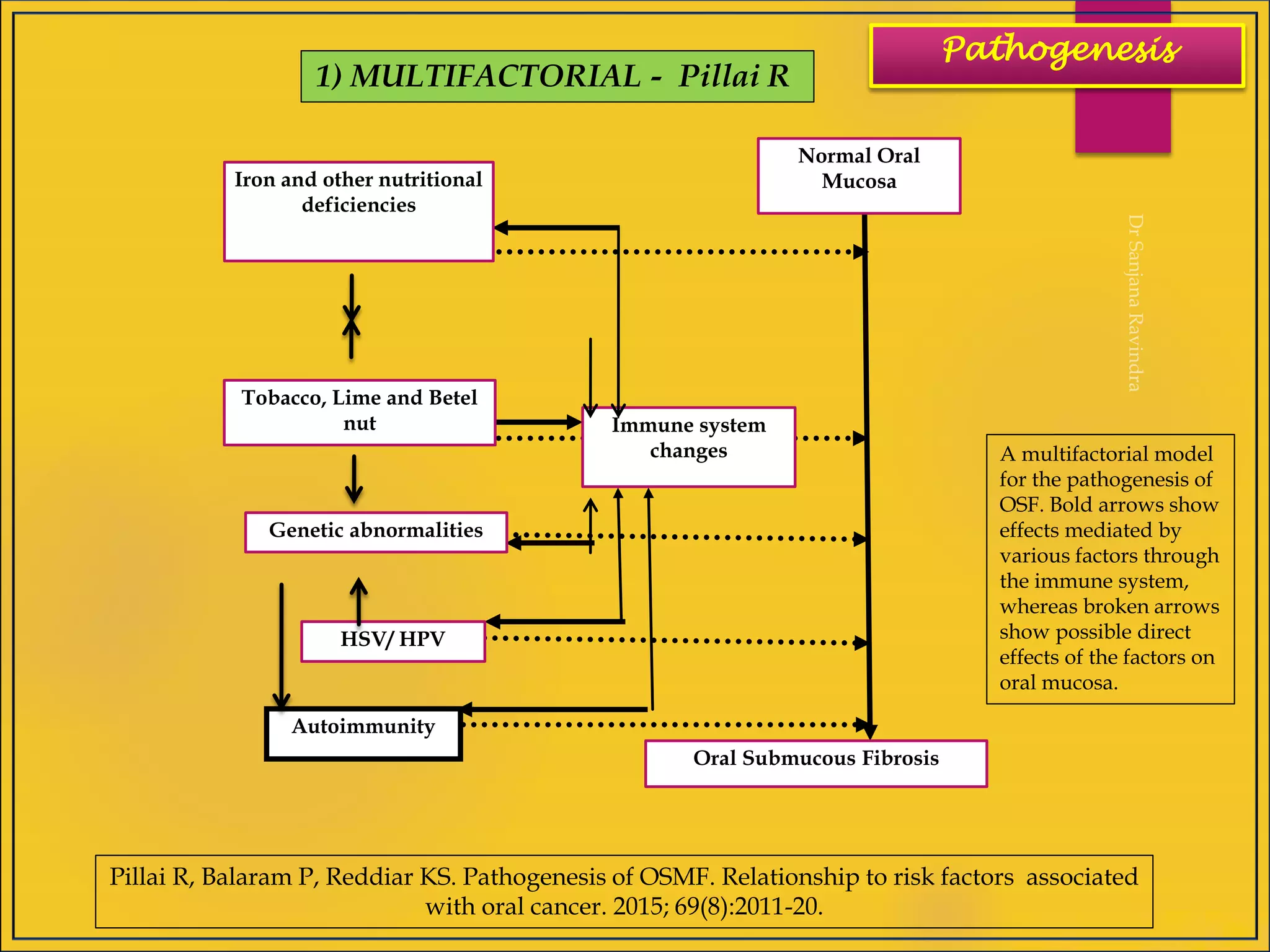 Oral Submucous Fibrosis - OSMF : Dr Sanjana Ravindra | PDF
