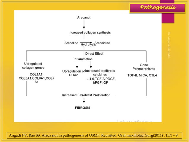 Oral Submucous Fibrosis - OSMF : Dr Sanjana Ravindra | PDF