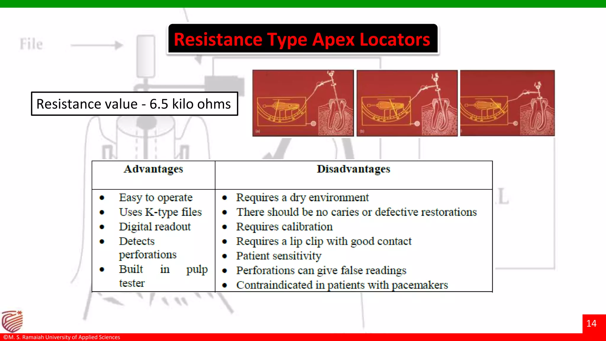 Electronic Apex Locator | PPTX