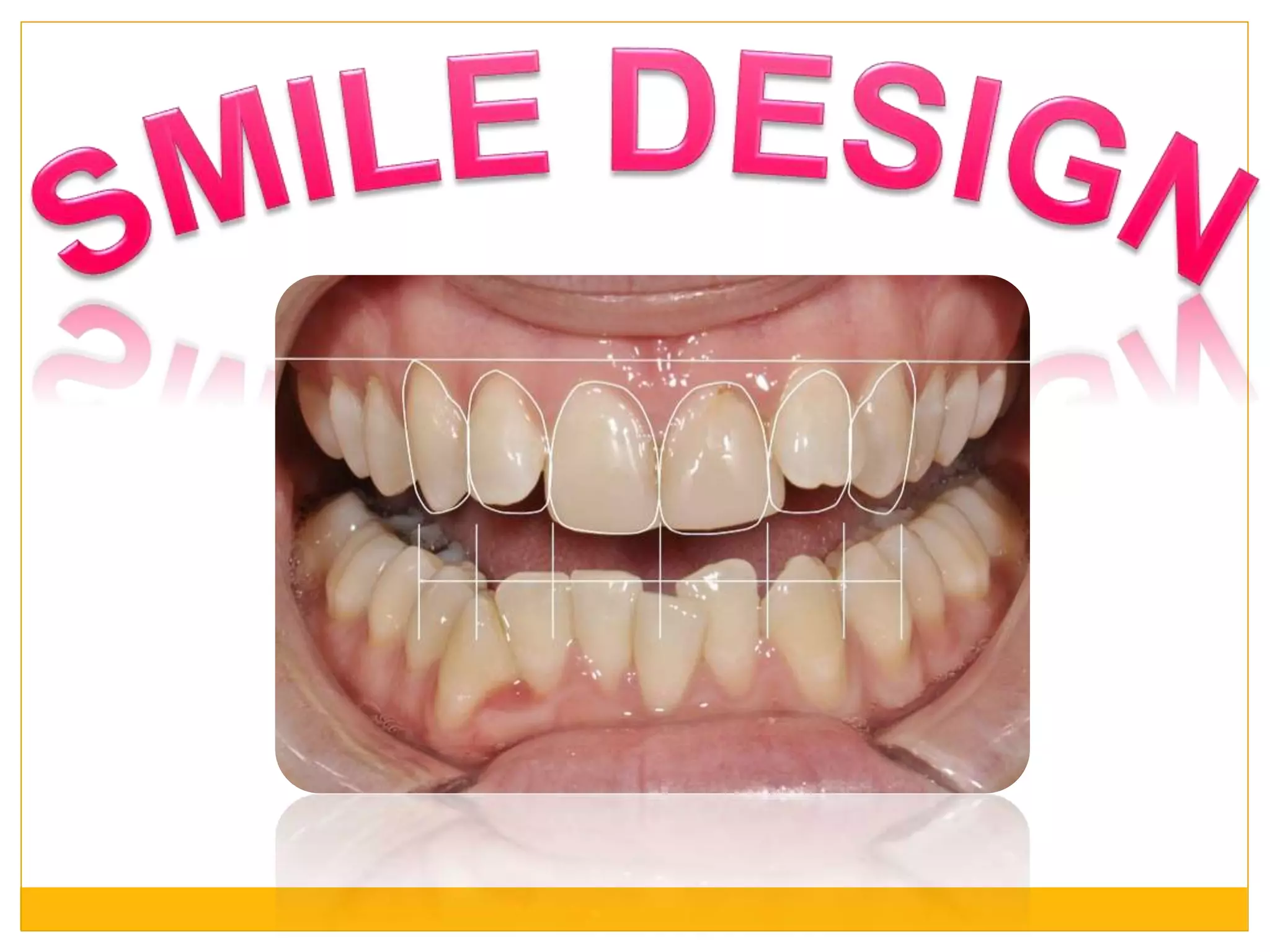 smile design | PPTX