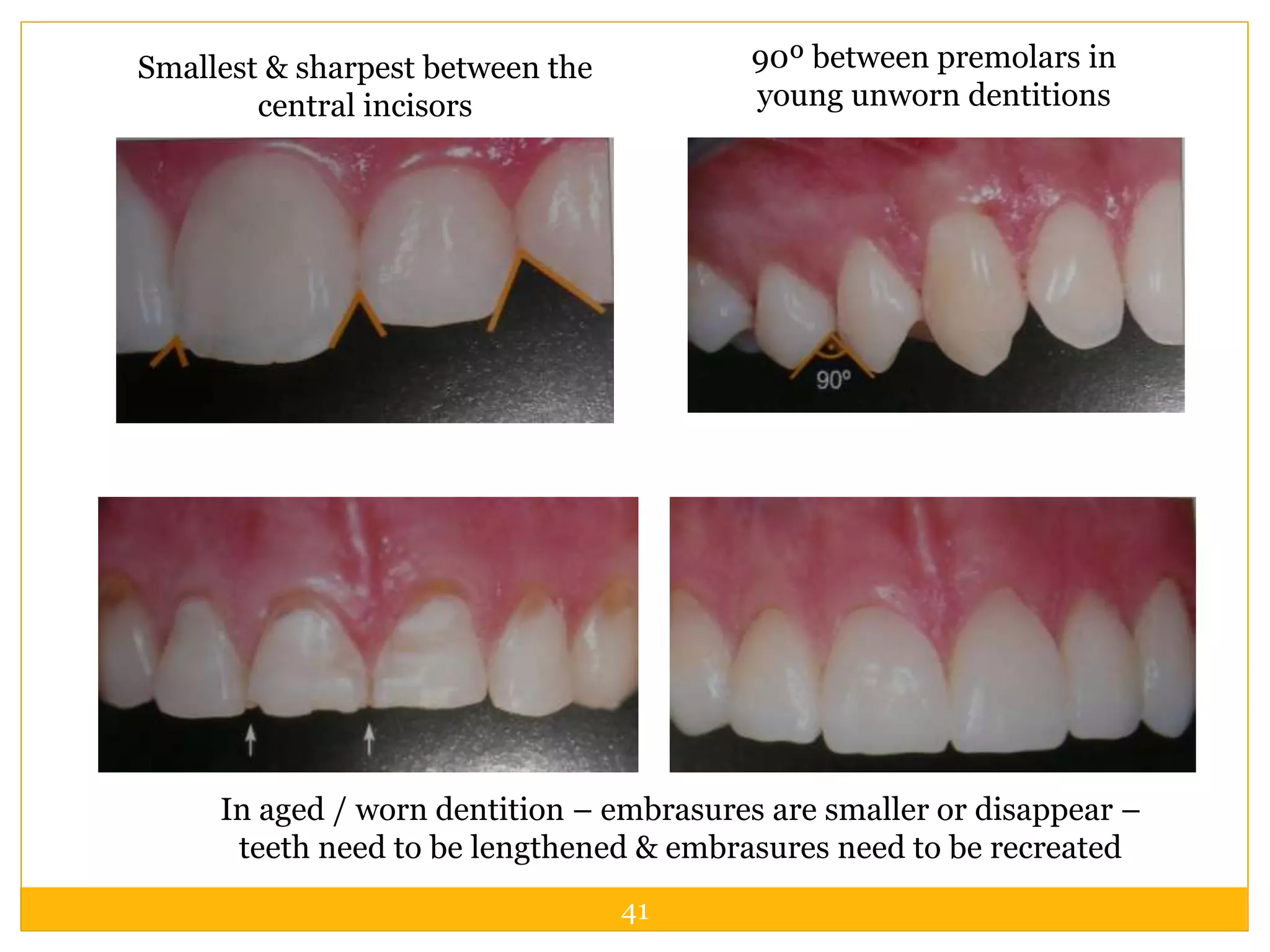 smile design | PPTX