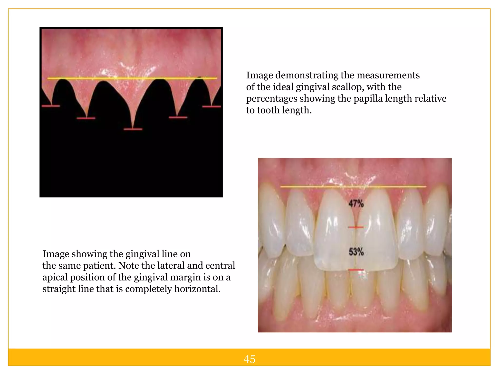 smile design | PPTX | Oral care | Personal Care