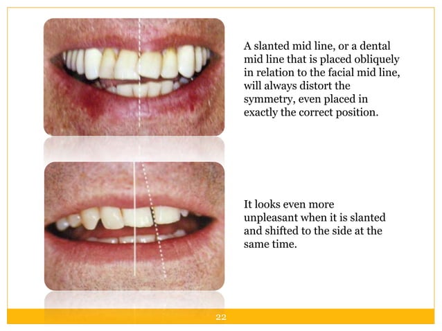 smile design | PPTX | Oral care | Personal Care